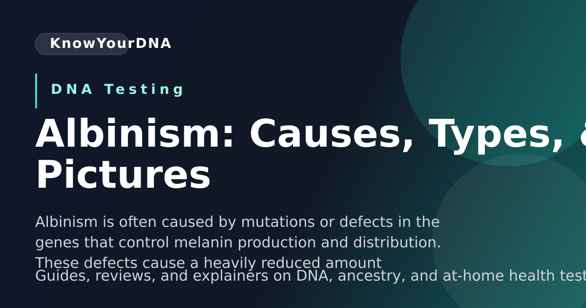 Albinism: Causes, Types, & Pictures